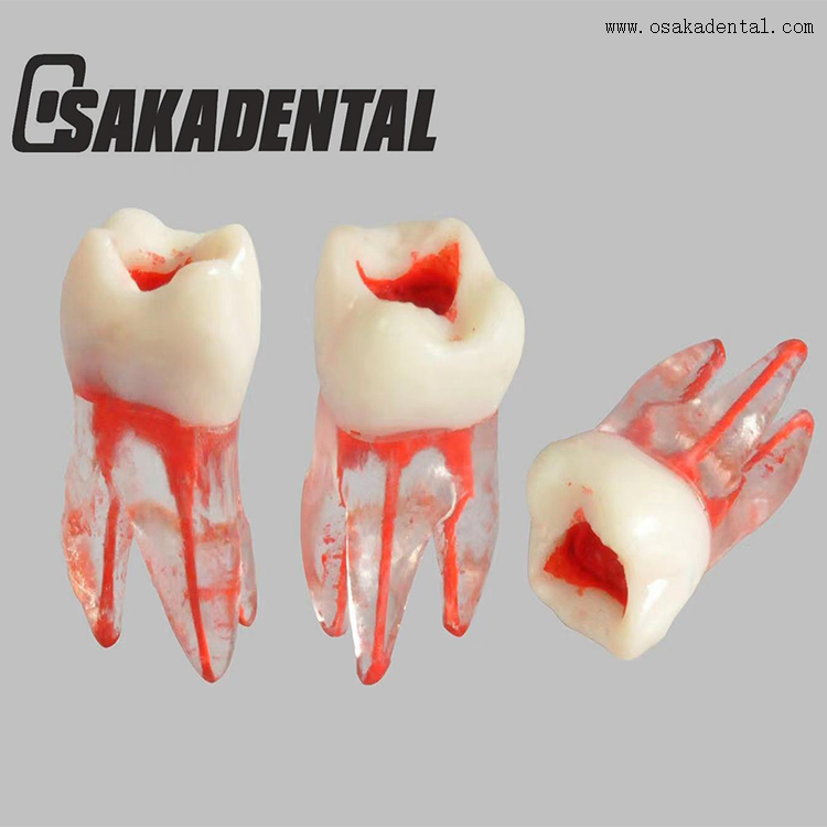 Dental Endodontic Root Canal Train Tooth Model - Buy Tooth Model, Root ...